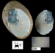 Diagnostic Artifacts in Maryland